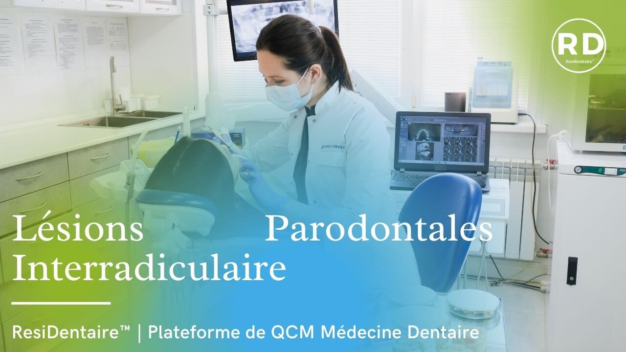 Lésions Parodontales Interradiculaire - Blog